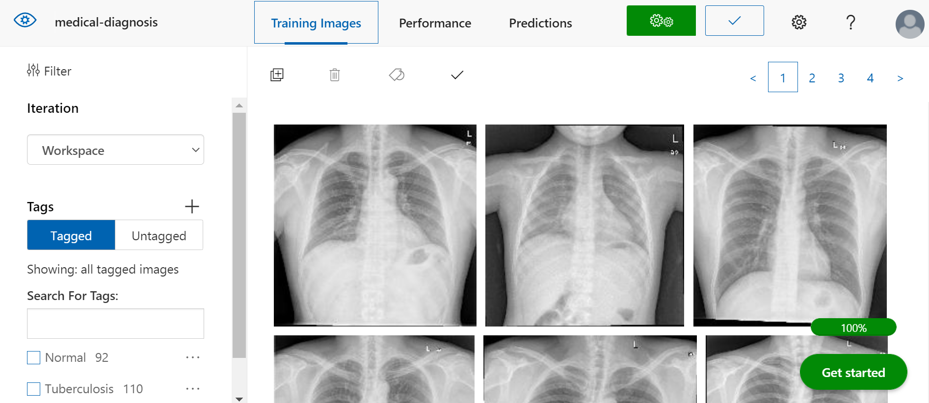 GitHub - enigmacoder-bot/tuberculosis-diagnosis GitHub - enigmacoder-bot/tuberculosis-diagnosis