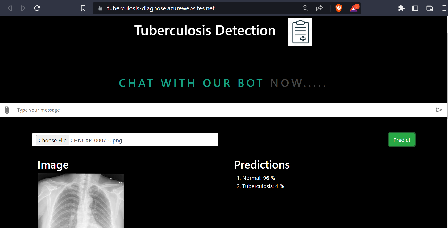 GitHub - enigmacoder-bot/tuberculosis-diagnosis