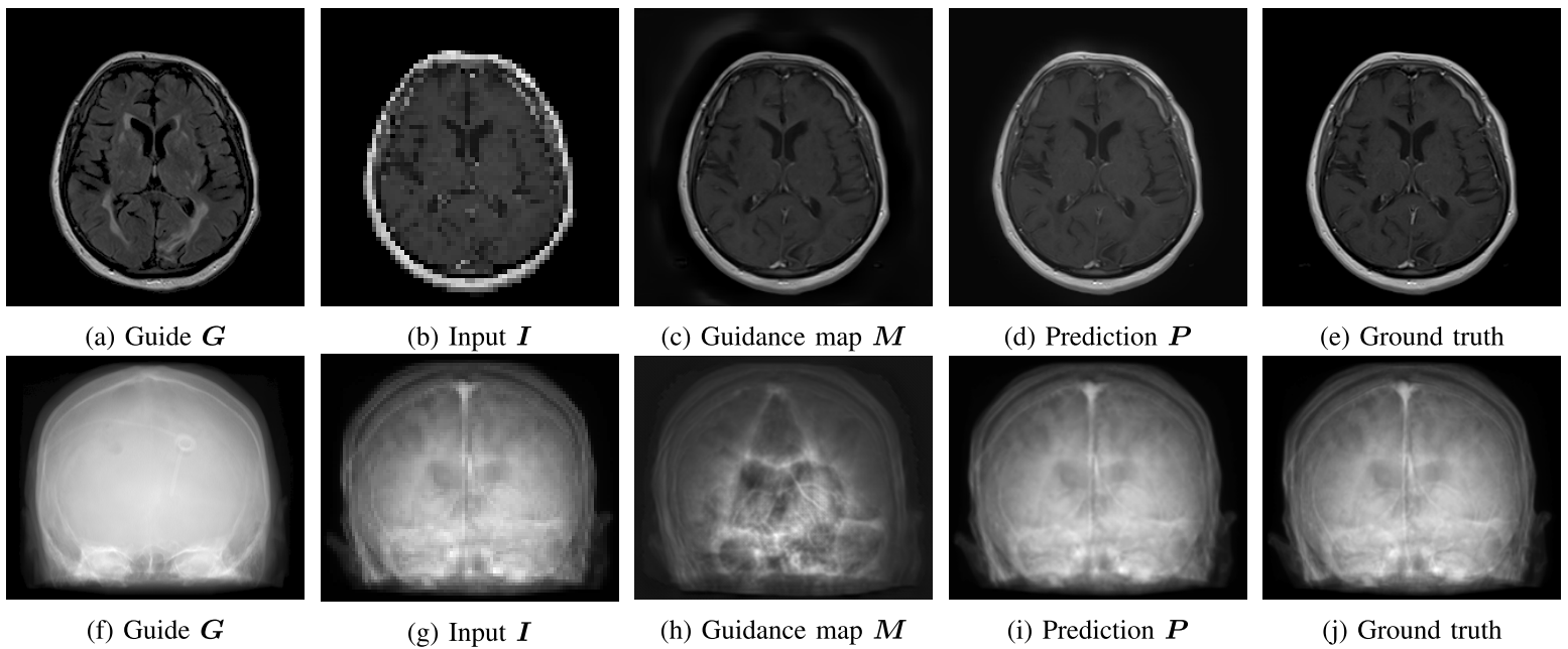 Multi-Modal Deep Guided Filtering for Comprehensible Medical Image ...