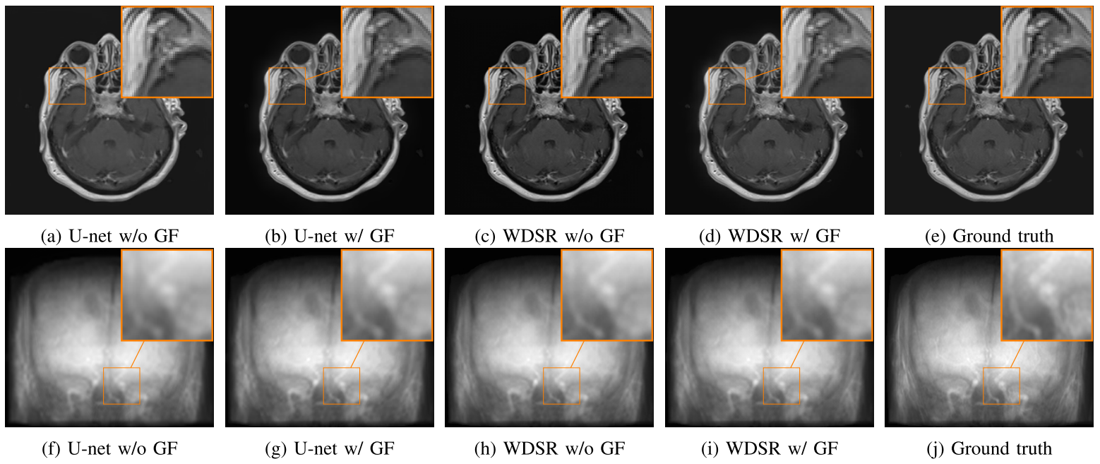 Multi-Modal Deep Guided Filtering for Comprehensible Medical Image ...