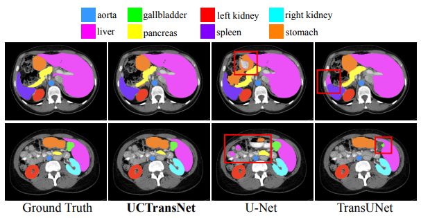 UCTransNet: Rethinking the Skip Connections in U-Net from a Channel ...