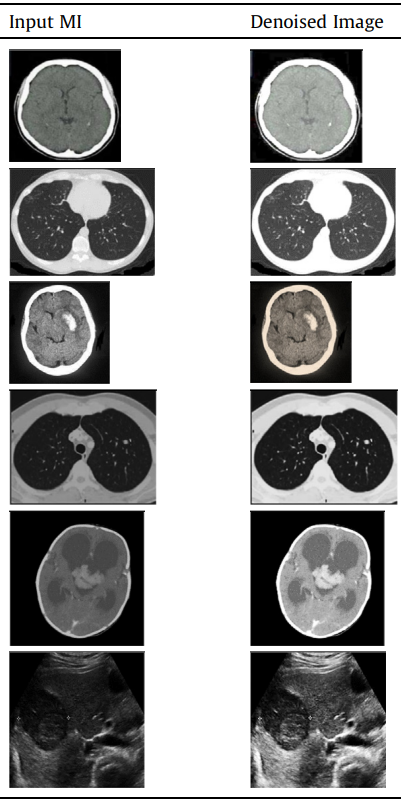 Optimal bilateral filter and Convolutional Neural Network based ...