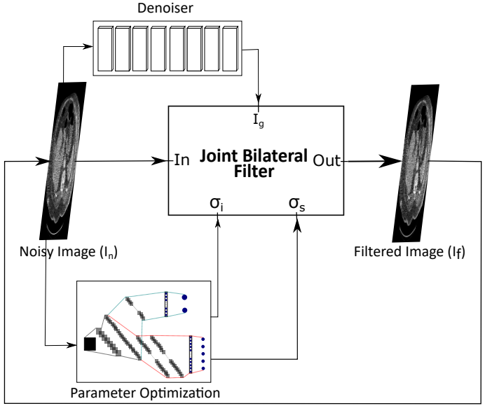Low Dose CT Denoising via Joint Bilateral Filtering and Intelligent Parameter Optimization ...
