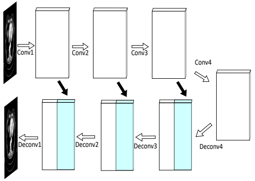 Low Dose CT Denoising via Joint Bilateral Filtering and Intelligent ...
