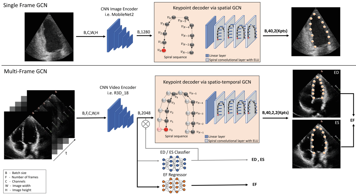 Light-weight spatio-temporal graphs for segmentation and ejection fraction prediction in cardiac ...