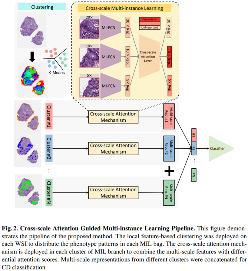Cross-scale Attention Guided Multi-instance Learning for Crohn’s ...