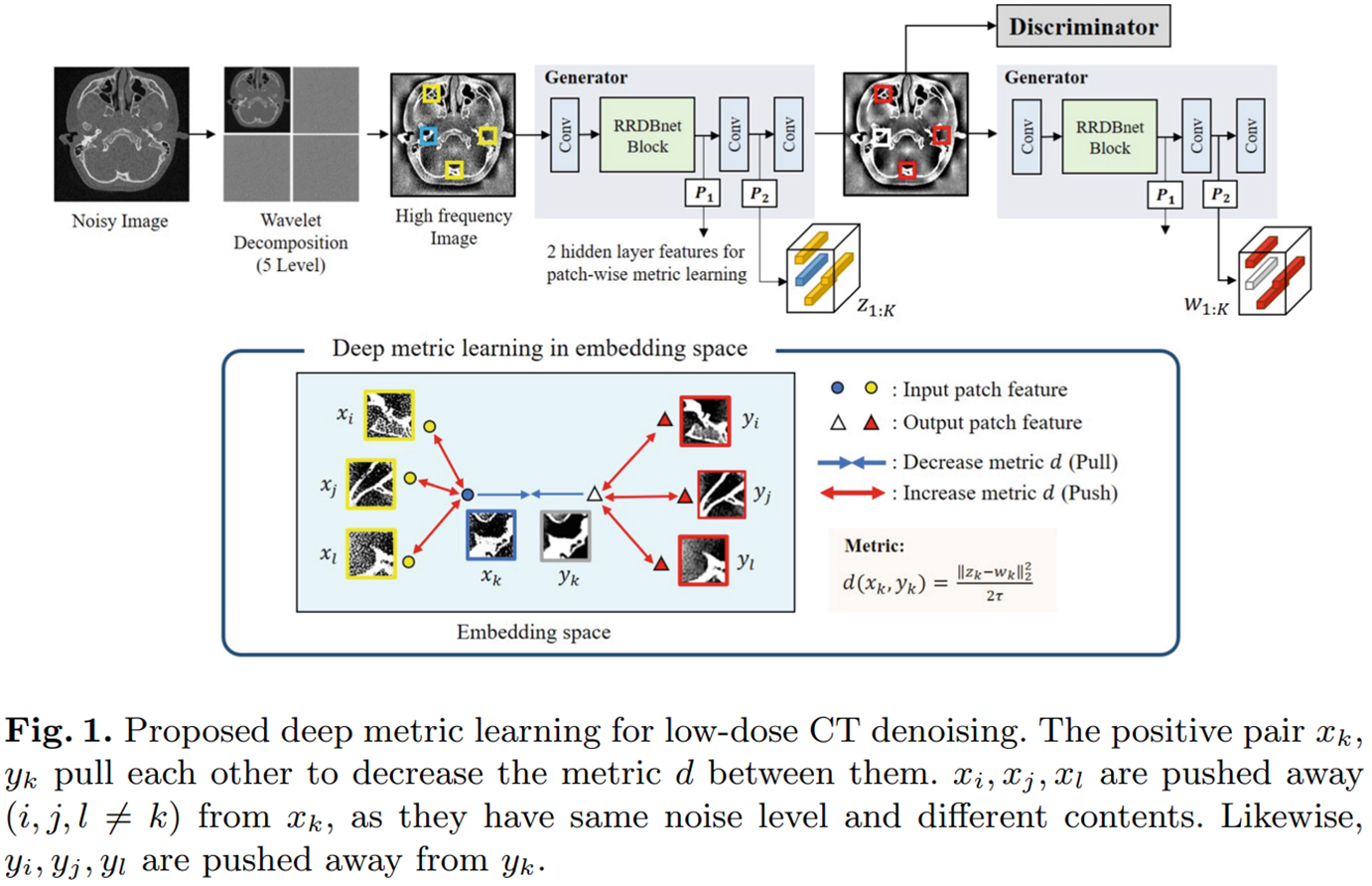 Patch-wise Deep Metric Learning for Unsupervised Low-Dose CT Denoising · Issue #310 · One-Day ...