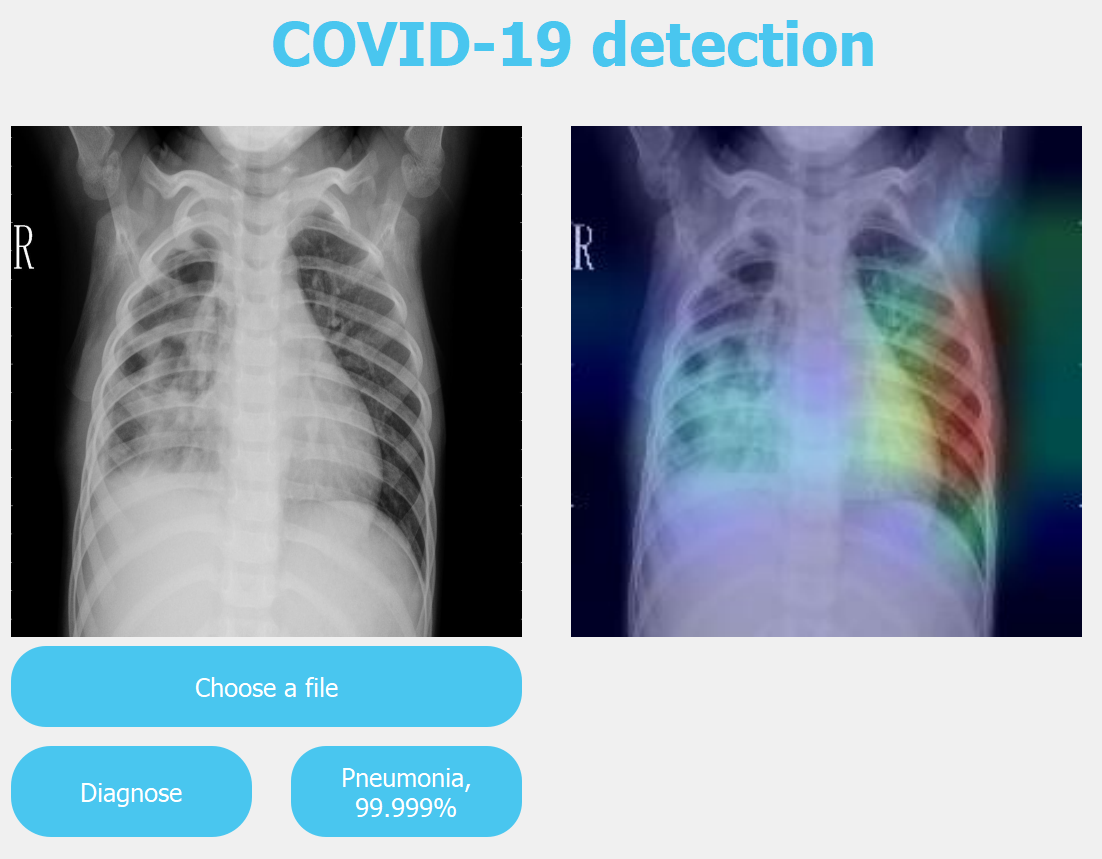 GitHub - mohdakrory/AI-Based-Medical-Diagnosis-System: An AI-based ...