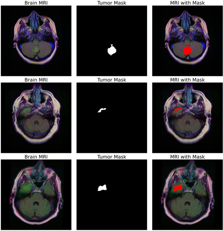 GitHub - mohdakrory/AI-Based-Medical-Diagnosis-System: An AI-based ...
