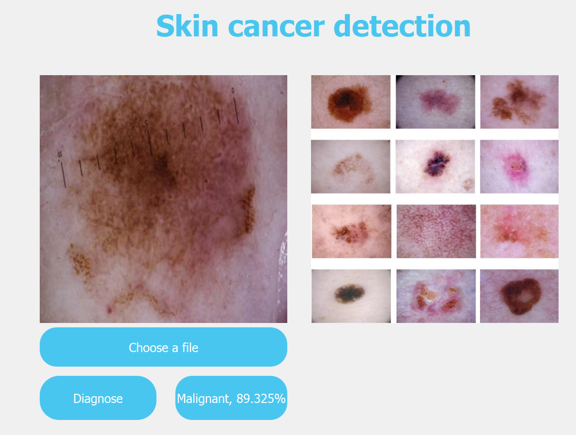 GitHub - mohdakrory/AI-Based-Medical-Diagnosis-System: An AI-based ...