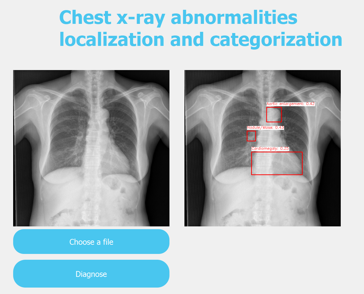 GitHub - mohdakrory/AI-Based-Medical-Diagnosis-System: An AI-based ...
