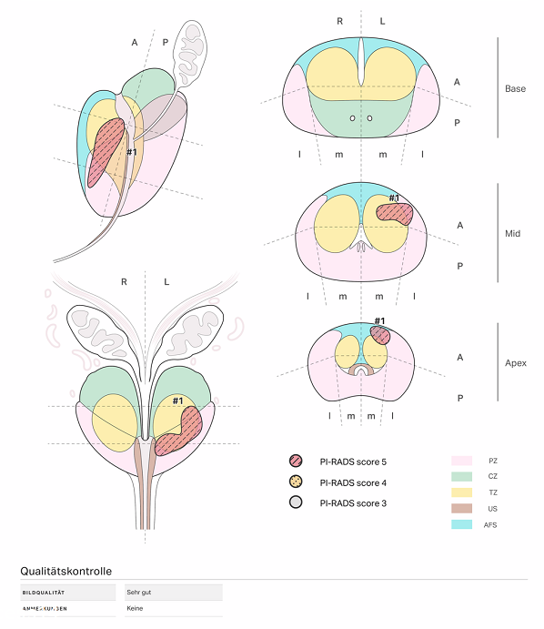 Photometric Interpretation After Decoding Not Updated · Issue 1497 · Fo Dicomfo Dicom · Github