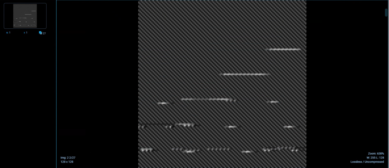 Problem rendering some US images. · Issue #2521 · OHIF/Viewers · GitHub