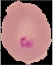 GitHub - pulkitkhandelwal29/Malaria-Cell-Image-Classification: Convolutional Neural Network (CNN)