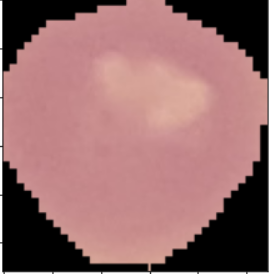 GitHub - pulkitkhandelwal29/Malaria-Cell-Image-Classification: Convolutional Neural Network (CNN)