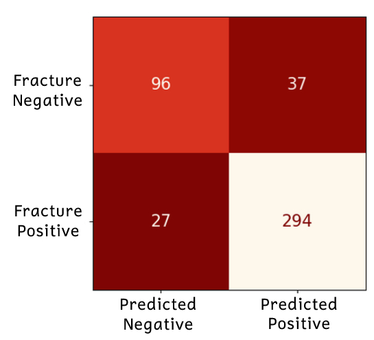 GitHub - noneedanick/bonefracturedetection: Object detection model ...