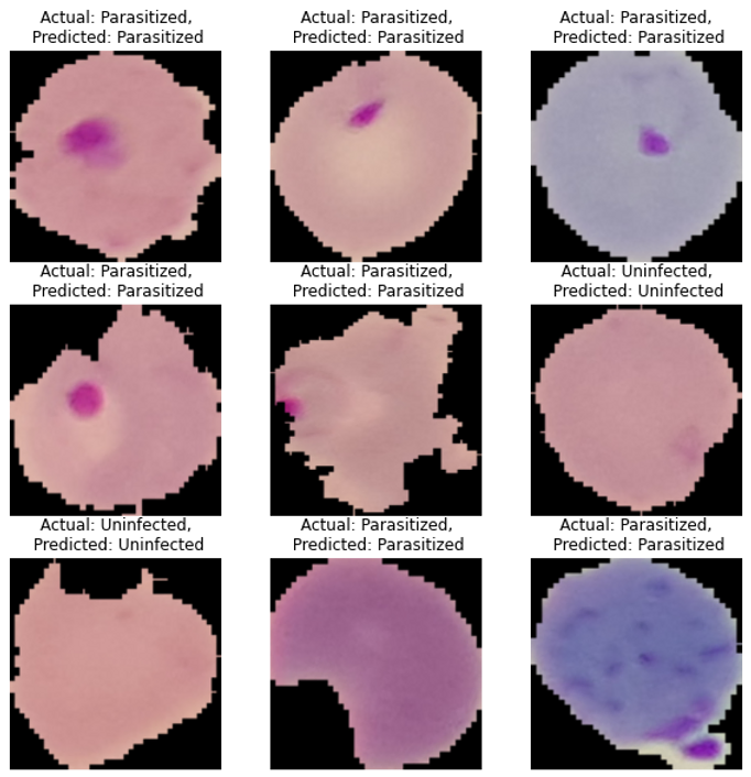 Github Udbhavtripathi Transfer Learning For Malaria Detection