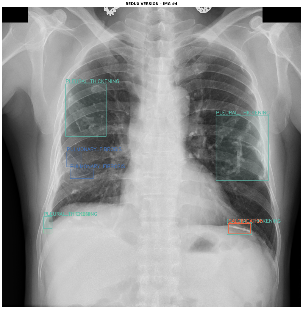 Github Indswetrust Vinbigdata Chest Xray Abnormalities Detection
