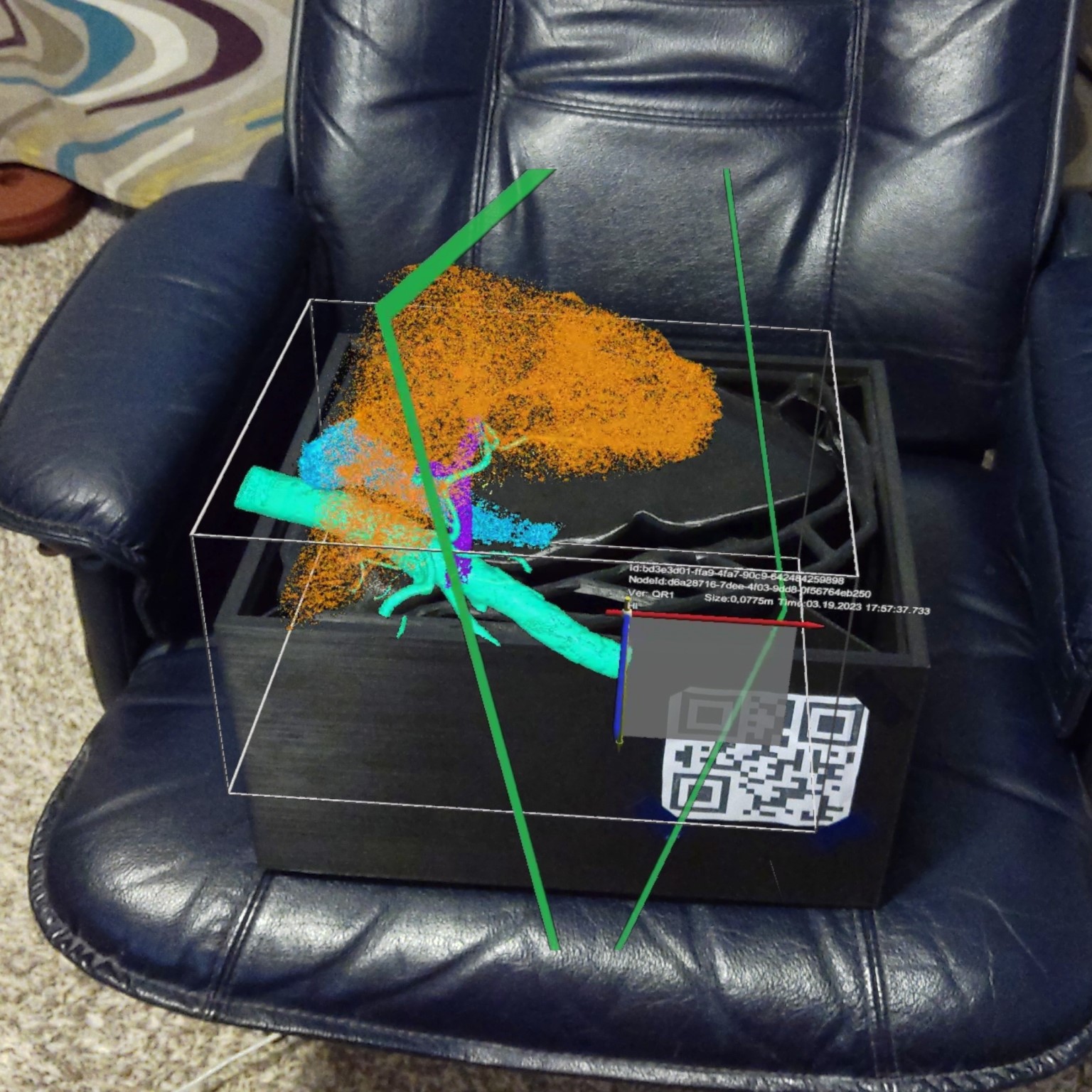 GitHub - SitronX/FnO-Hololens2-visualisation: Medical visualisations using AR/VR. Project is ...