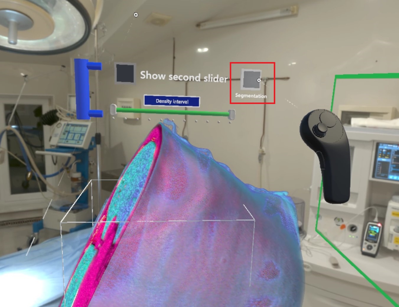 GitHub - SitronX/FnO-Hololens2-visualisation: Medical visualisations using AR/VR. Project is ...