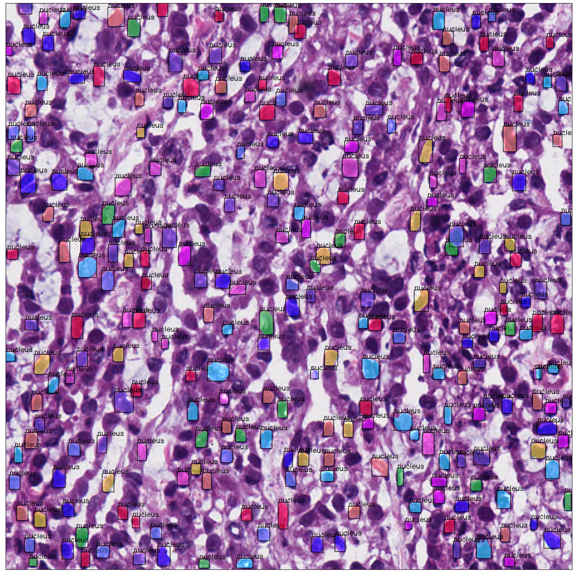 GitHub - Aadesh-1404/nuclei-segmentation-classification