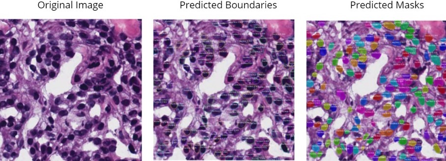 GitHub - Aadesh-1404/nuclei-segmentation-classification