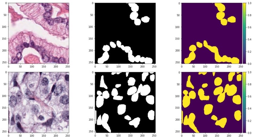GitHub - Aadesh-1404/nuclei-segmentation-classification