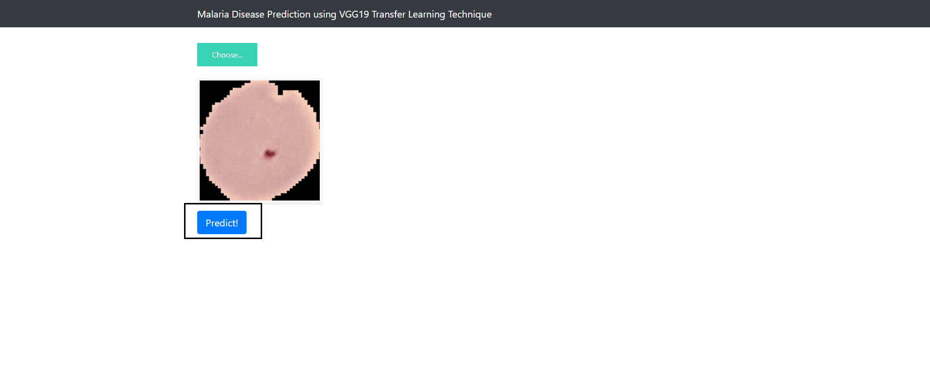 GitHub - Kishorlal/Malaria-Disease-Prediction-using-VGG19-Transfer-Learning-Technique: The Aim ...