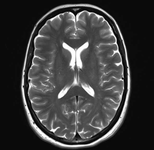GitHub - eleka-12/tumour-classification-pytorch