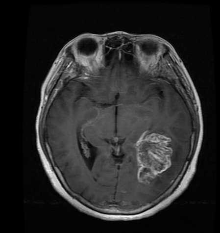 GitHub - eleka-12/tumour-classification-pytorch