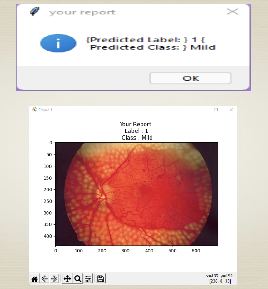 GitHub - Amanaj7722/Classification-of-Retinal-Diseases-using-RESNET-Model: Developing a computer ...