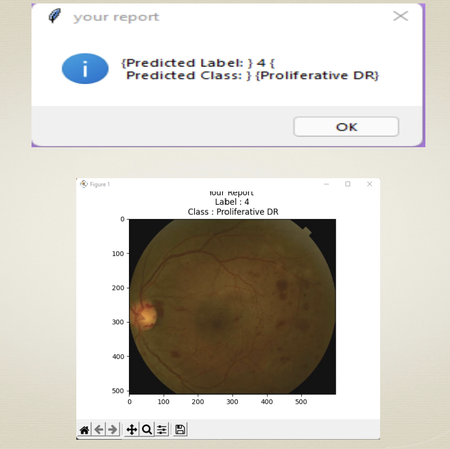 GitHub - Amanaj7722/Classification-of-Retinal-Diseases-using-RESNET ...