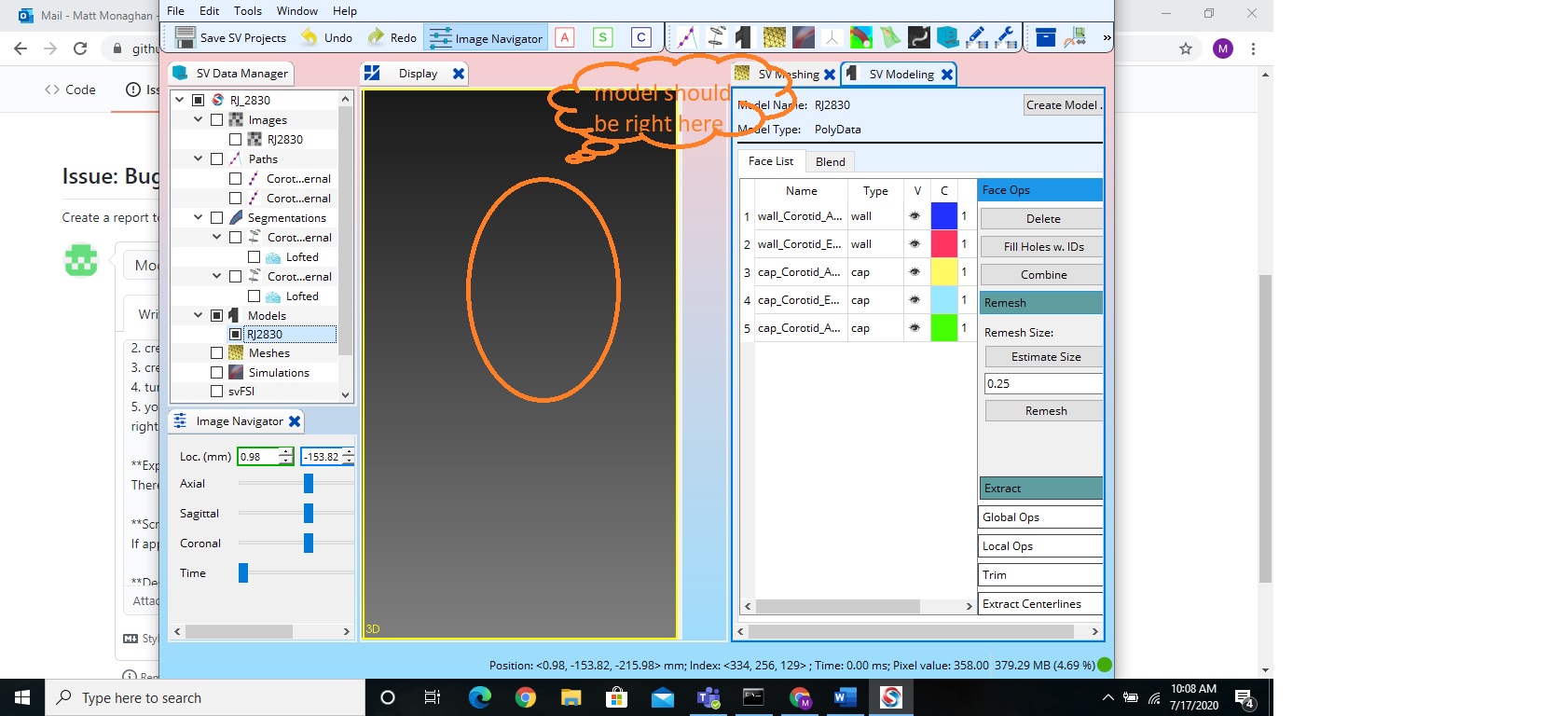 Modeling issue · Issue #694 · SimVascular/SimVascular · GitHub