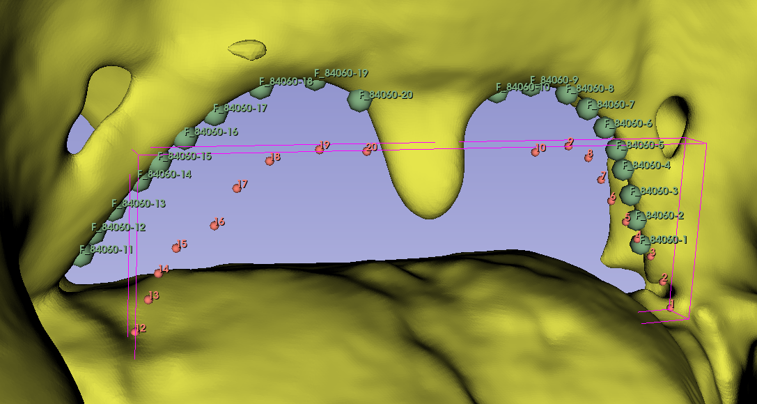 PC wrapped model orientation in GPA Module · Issue #194 · SlicerMorph/SlicerMorph · GitHub