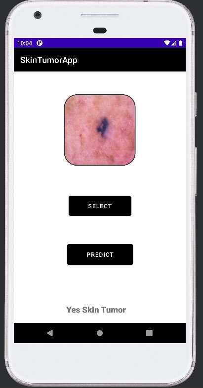 GitHub - aydemiralp/Skincancerclassificationapp