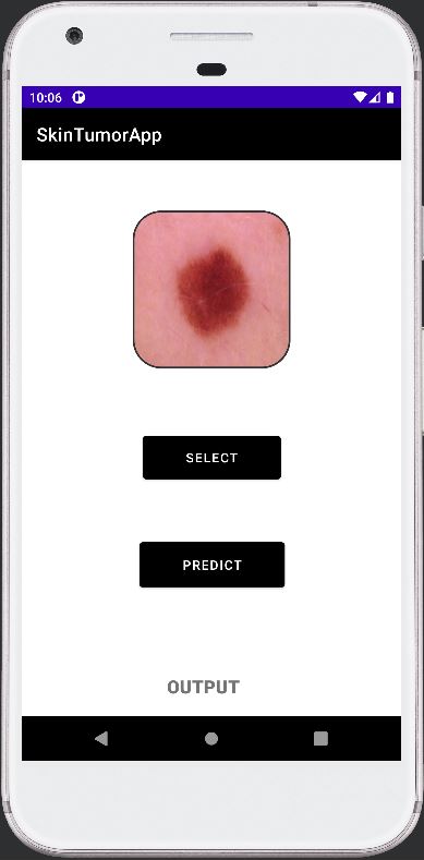 GitHub - aydemiralp/Skincancerclassificationapp