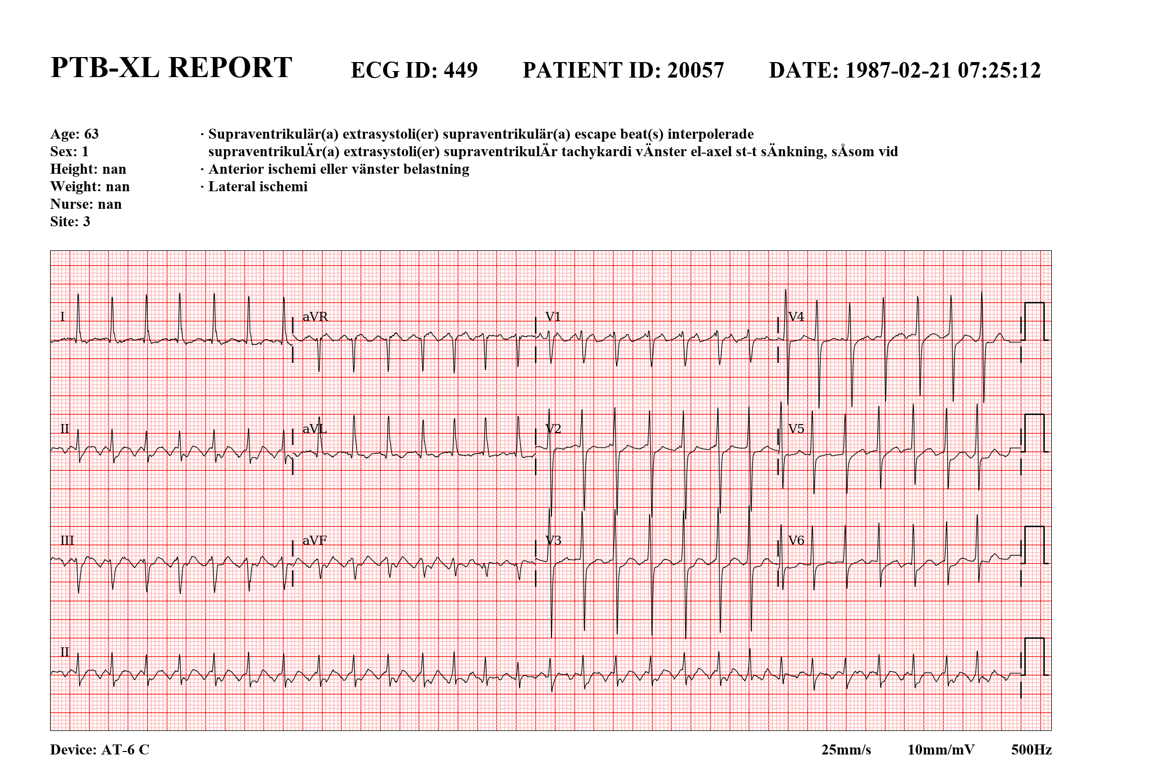 GitHub - adofersan/ecg-miner
