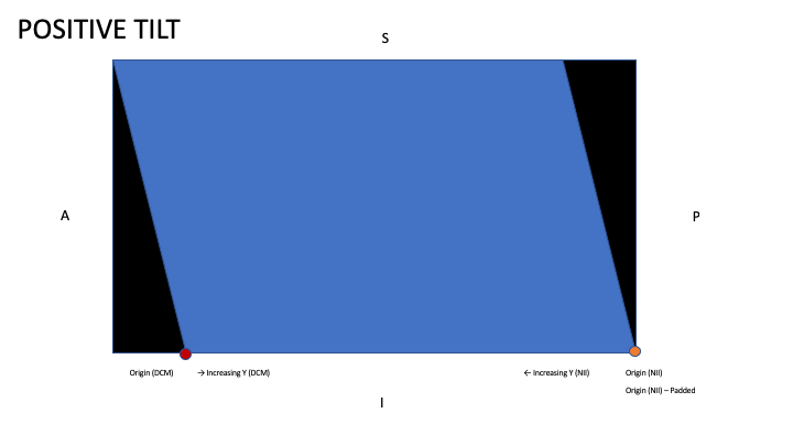 Incorrect origin for tilt-corrected NIfTI images · Issue #259 ...