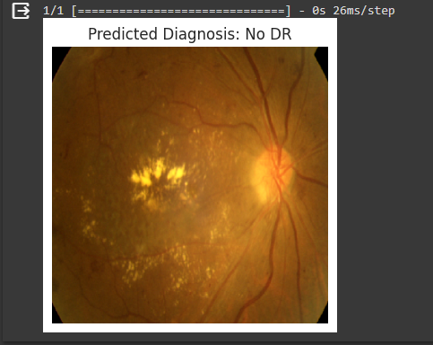 GitHub - CaptainYogs/Blindness-Detection