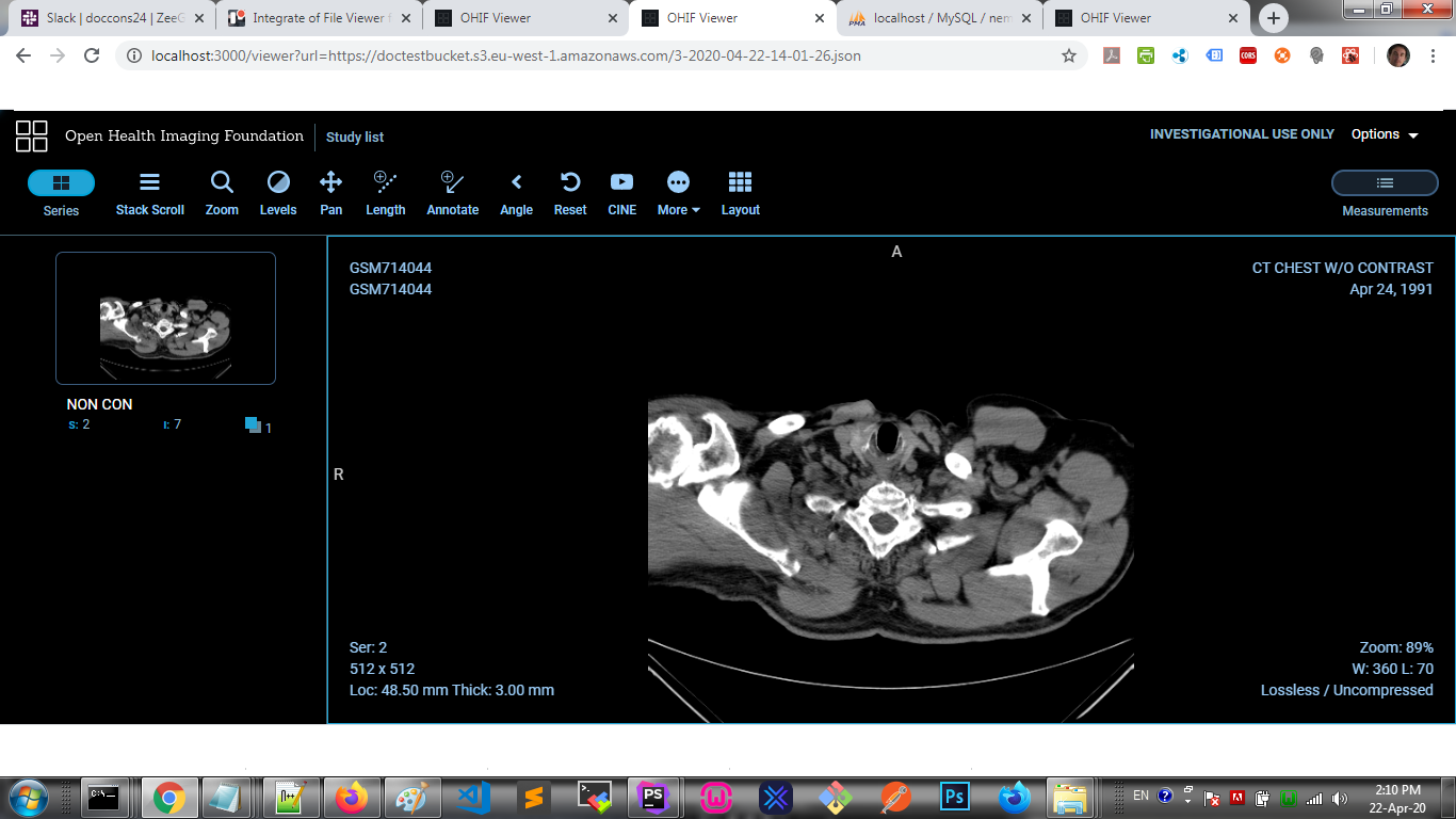 OHIF viewer with access json file to s3 storage not load dicom file · Issue #1657 · OHIF/Viewers ...