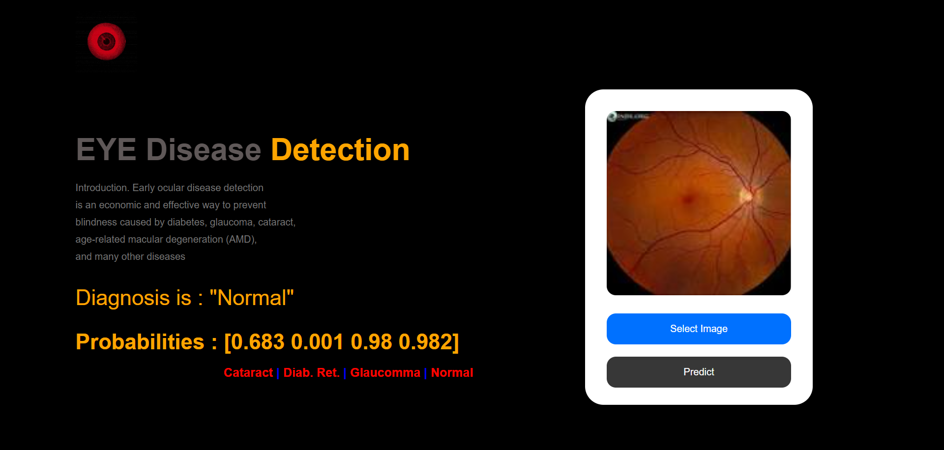 Github Sanjays50eye Disease Classigication And Detection A Cnn Based Deep Learning Model To