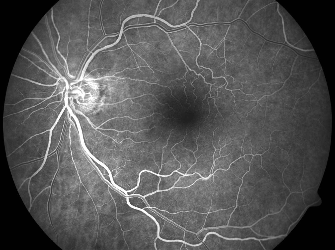GitHub - PUT-Knowledge-engineering/Kubiak_Strak: Recognition of blood vessels in angiographic ...