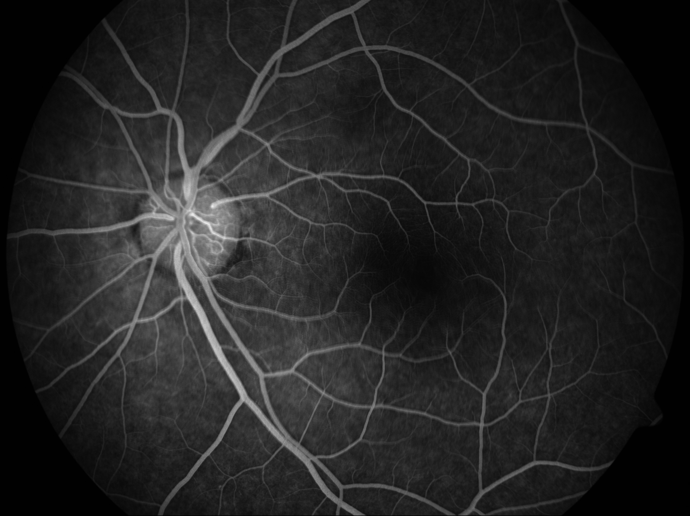 GitHub - PUT-Knowledge-engineering/Kubiak_Strak: Recognition of blood vessels in angiographic ...