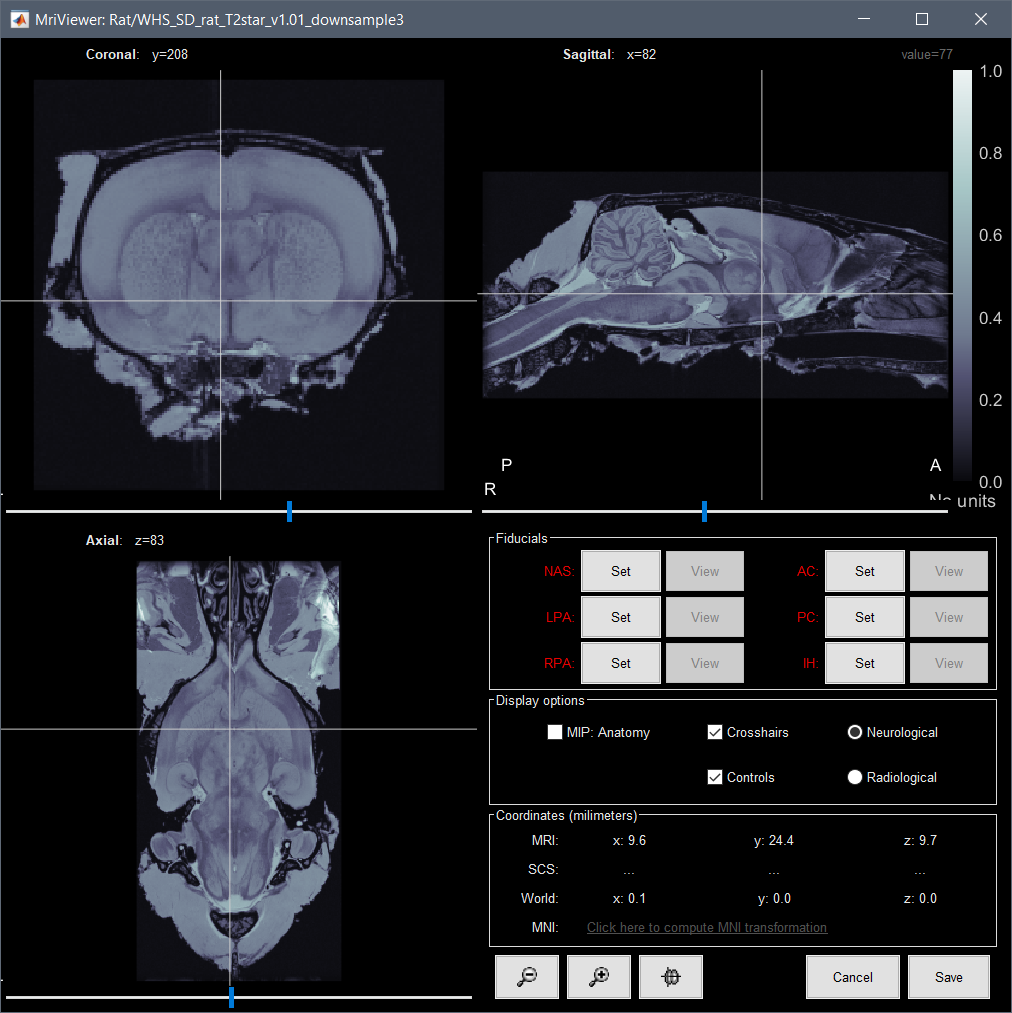 MRI viewer offset · Issue #263 · brainstorm-tools/brainstorm3 · GitHub