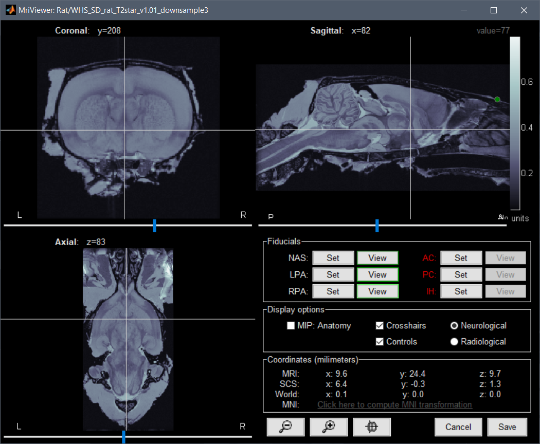 MRI viewer offset · Issue #263 · brainstorm-tools/brainstorm3 · GitHub