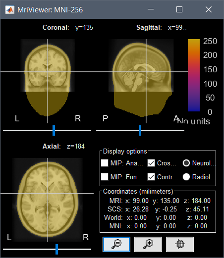 new method for defacing MRI (3D and 4D volume) · Issue #307 ...