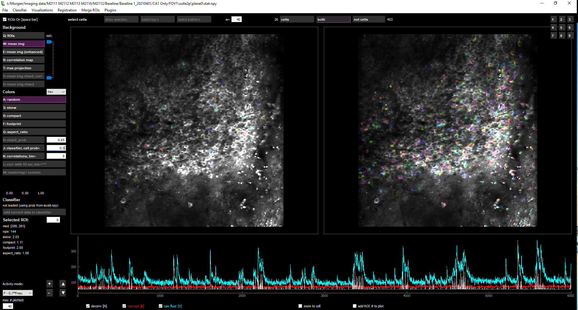running anatomical_only gives an error · Issue #736 · MouseLand/suite2p · GitHub