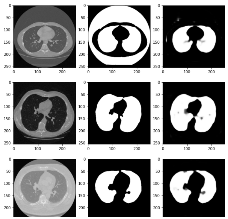 GitHub - Byeon-MJ/CT_Image_Segmentation: CT Image Segmentation Repository