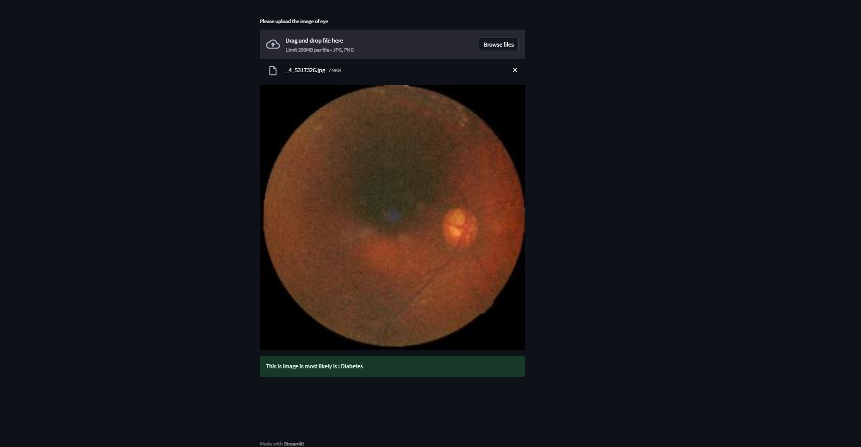 GitHub - ishivamsharma/eye_disease_detection