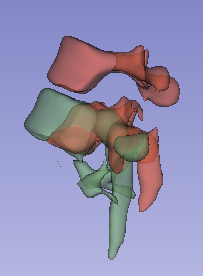 Problems about Organ Segmentation Overlapping · Issue #168 · wasserth/TotalSegmentator · GitHub